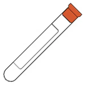 Ecommerce platform - Red Top Blood Collection Tubes Plastic 10ml 100/bx ...